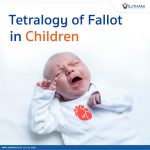 Tetralogy of Fallot in Children