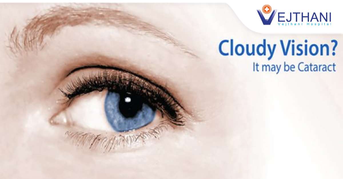 CLOUDY VISION? – GET A CATARACT SURGERY