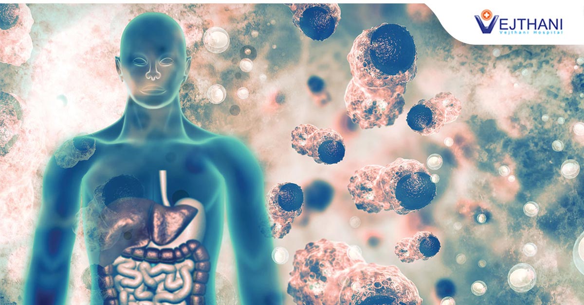 Chemotherapy to Treat Cancer - Vejthani Hospital