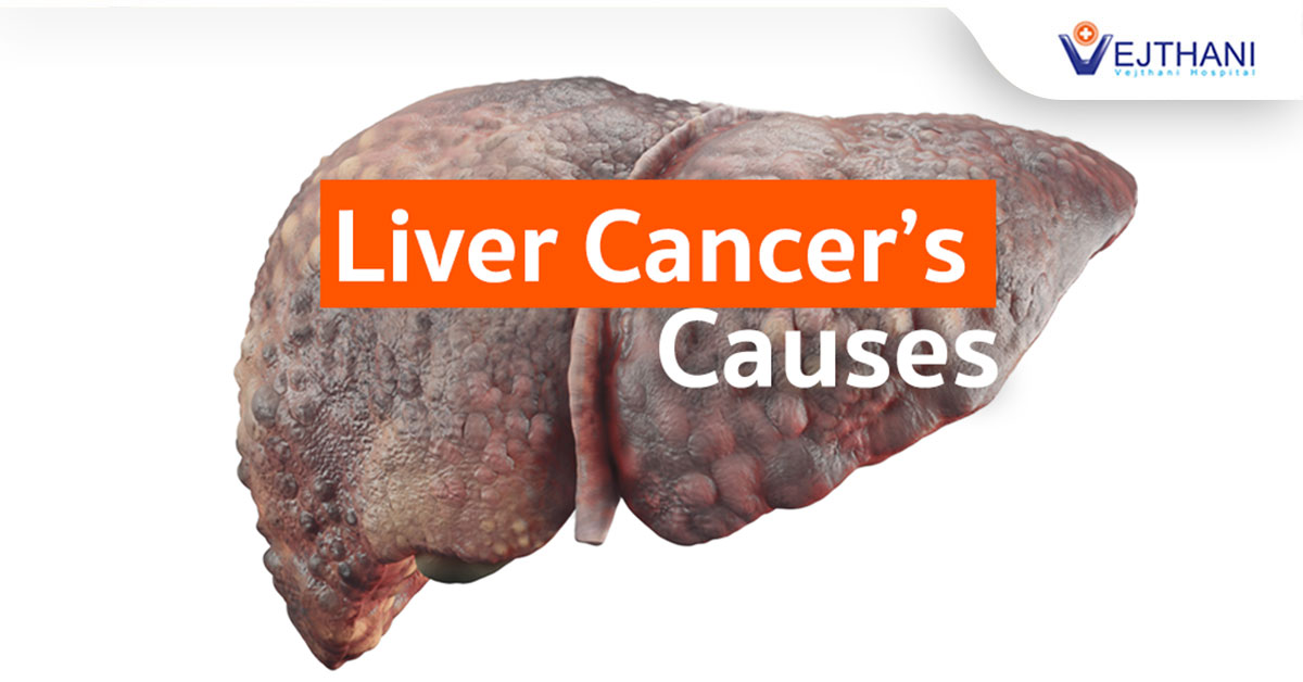Liver Cancer: Causes, Risks, and Prevention