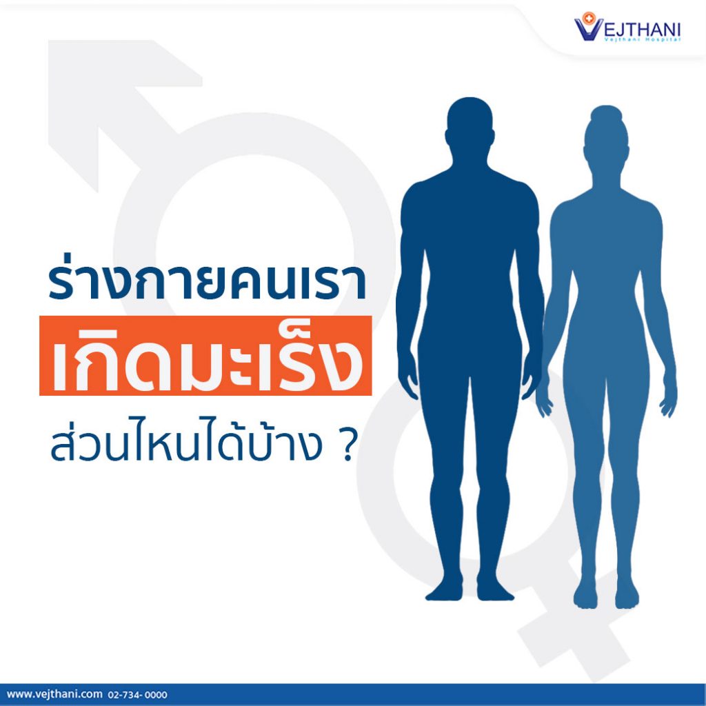 มะเร็งที่พบบ่อยในผู้ชาย
