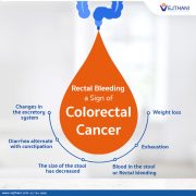 Blood in the Stool, a Sign of Colorectal Cancer