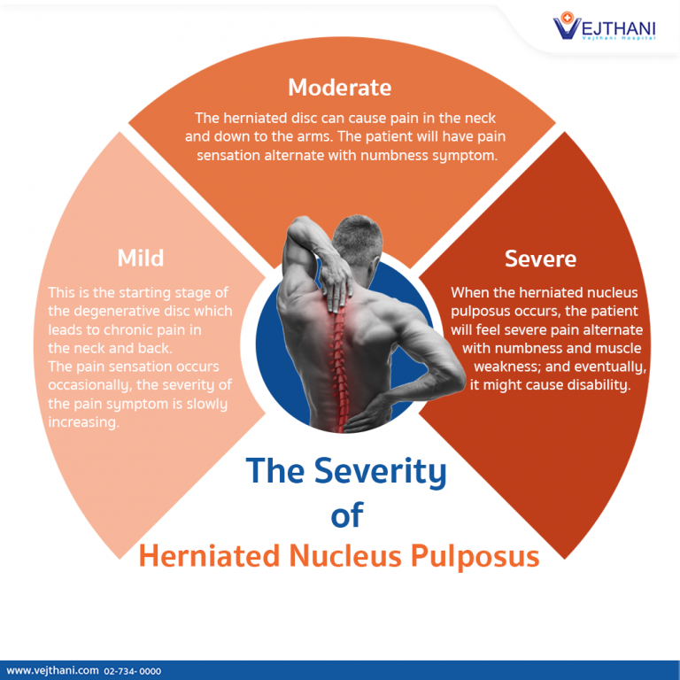 The Severity of Herniated Nucleus Pulposus