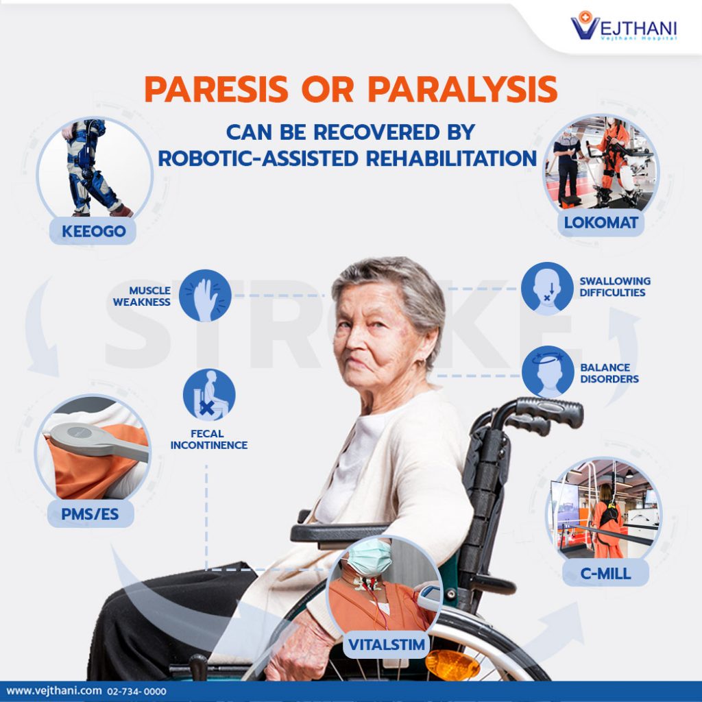 Paresis or Paralysis can be recovered by Robotic-Assisted Rehabilitation