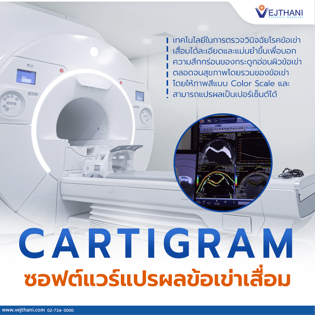 Cartigram ซอฟต์แวร์แปรผลข้อเข่าเสื่อม - Vejthani Hospital