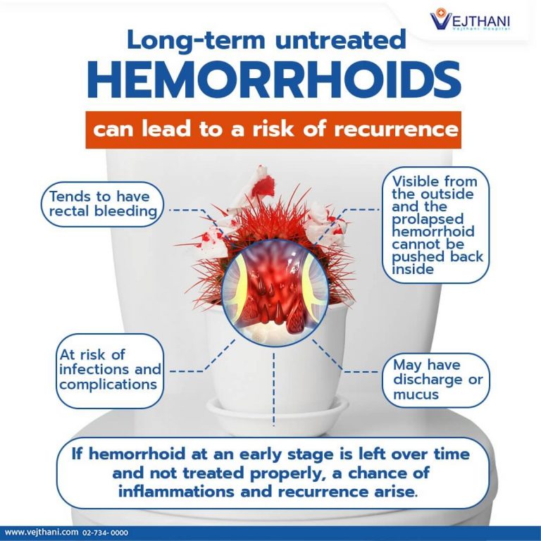 Long-term untreated Hemorrhoids can lead to a risk of recurrence