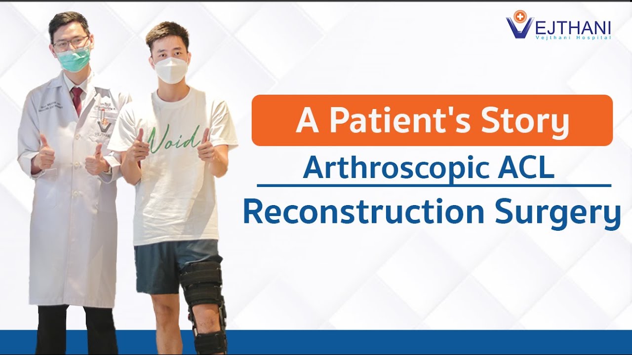 Arthroscopic ACL Reconstruction Surgery