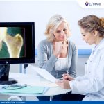 Should You Book An Osteoporosis Screening?