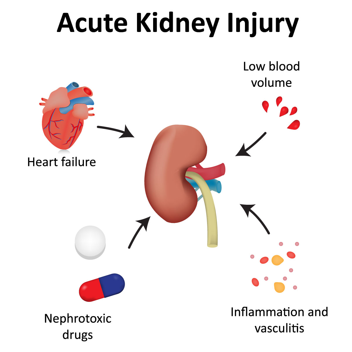 Understanding Acute Kidney Failure: Key Symptoms | Vejthani Understanding Acute Kidney Failure: Key Symptoms | Vejthani