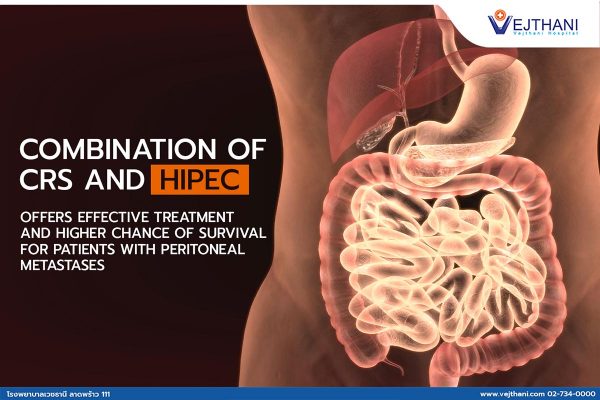 Combination of CRS and HIPEC offers Effective Treatment and Higher ...