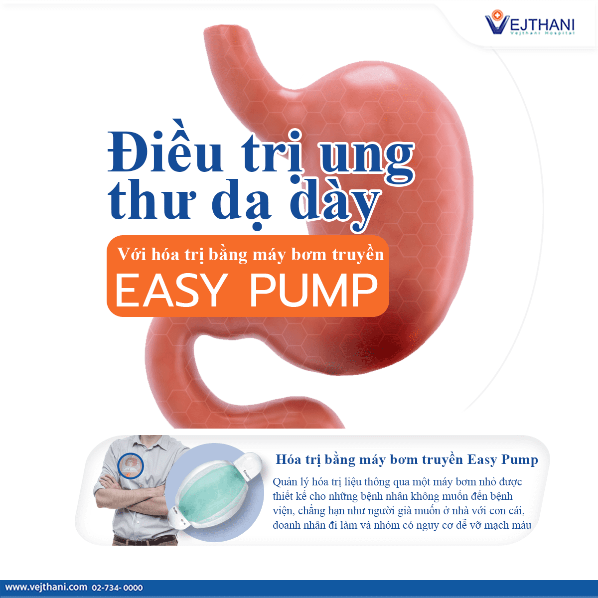 Điều trị ung thư dạ dày với hóa trị bằng máy bơm truyền Easy Pump ...