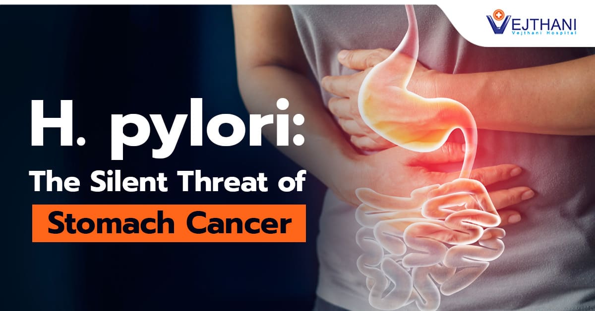 H. pylori: The Silent Threat of Stomach Cancer - Vejthani Hospital ...