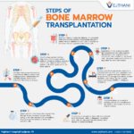 Steps of Bone Marrow Transplantation - Vejthani International Hospital ...