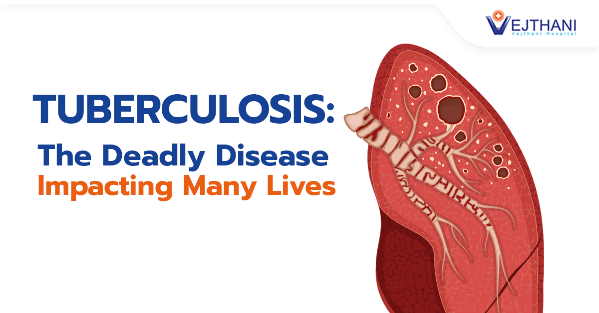 Tuberculosis: The Deadly Disease Impacting Many Lives