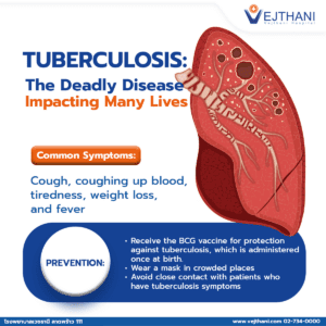 Tuberculosis: The Deadly Disease Impacting Many Lives