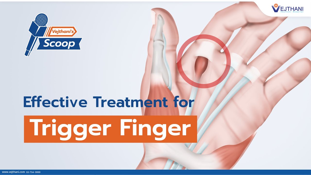Effective Treatment for Trigger Finger - Vejthani Hospital | JCI ...