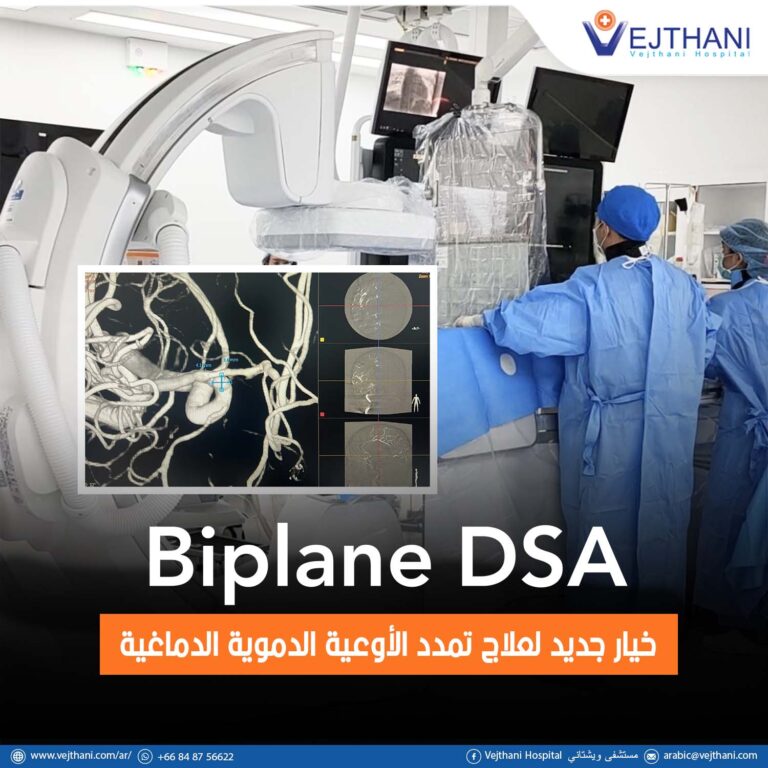 Biplane DSA : خيار جديد لعلاج تمدد الأوعية الدموية الدماغية. - Vejthani ...