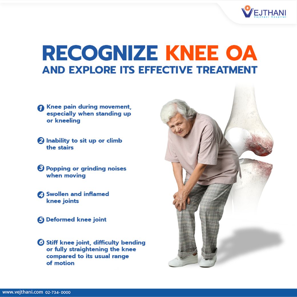 Recognize Knee OA and Explore Its Effective Treatment