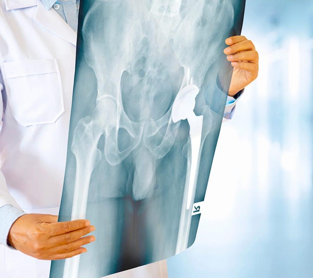 Robotic Joint Replacement - Vejthani International Hospital | JCI ...