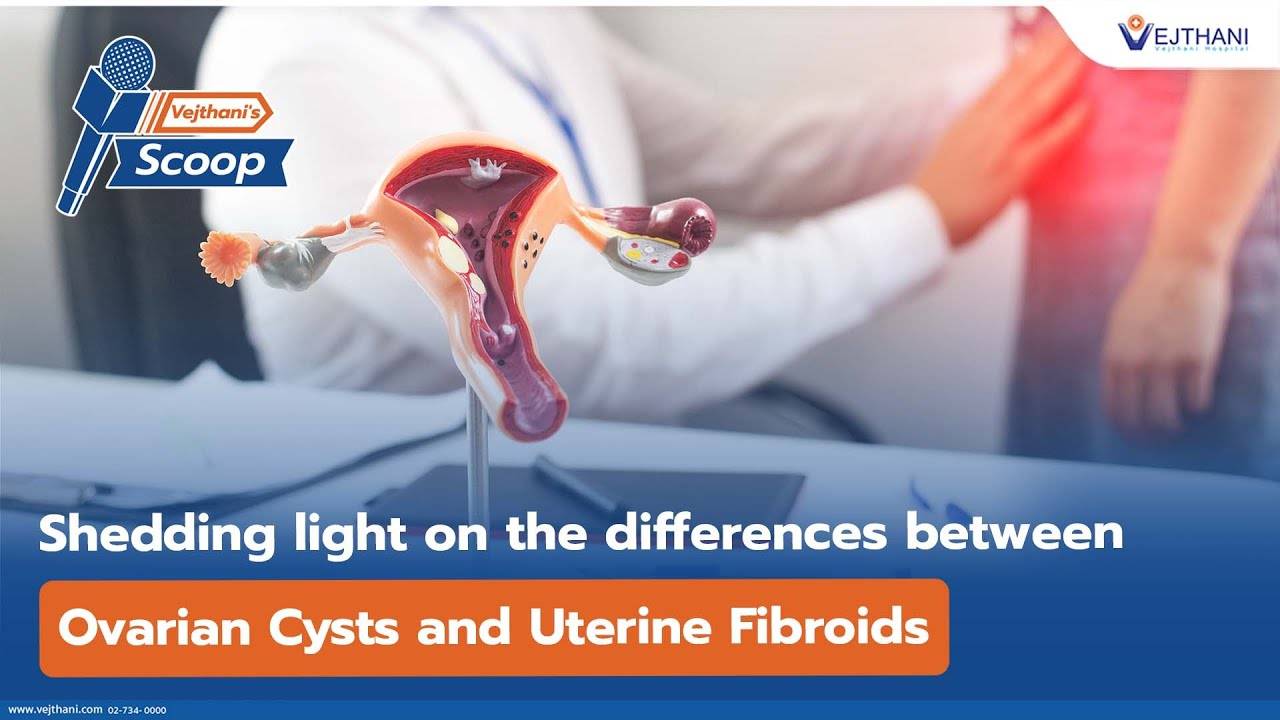 The differences between Ovarian Cysts and Uterine Fibroids