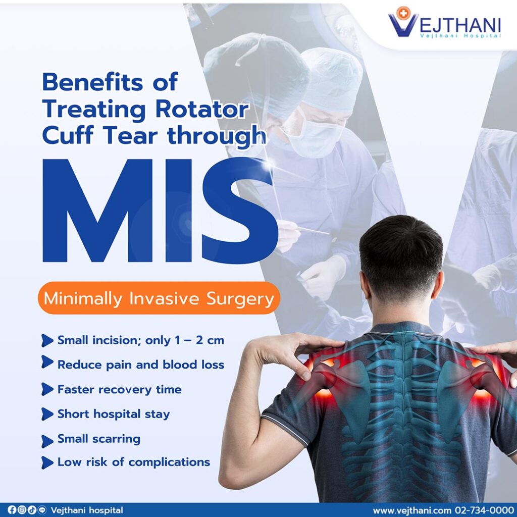 Benefits of Treating Rotator Cuff Tear through Endoscopic Minimally ...