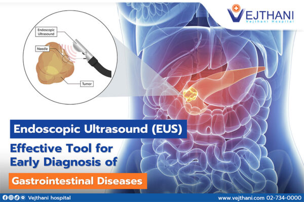 Endoscopic Ultrasound: Effective Tool for Early Diagnosis of ...