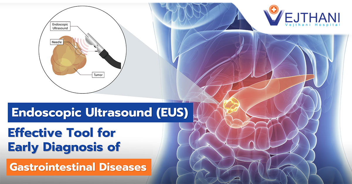 Endoscopic Ultrasound: Effective Tool for Early Diagnosis of ...