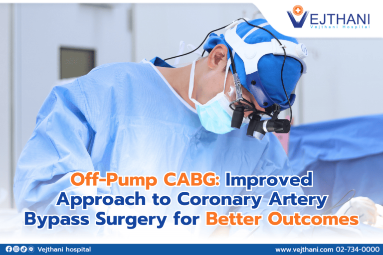 Off-Pump CABG: Improved Approach to Coronary Artery Bypass Surgery for Better Outcomes