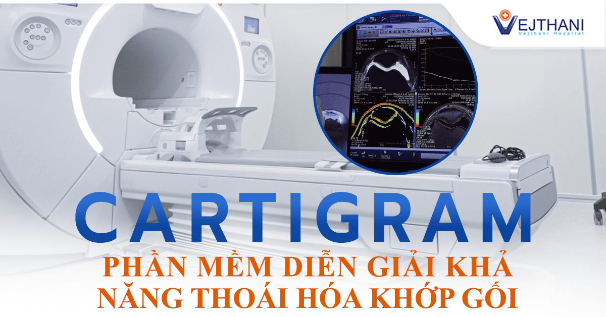 Cartigram - Phần mềm diễn giải khả năng Thoái hóa khớp gối - Vejthani ...