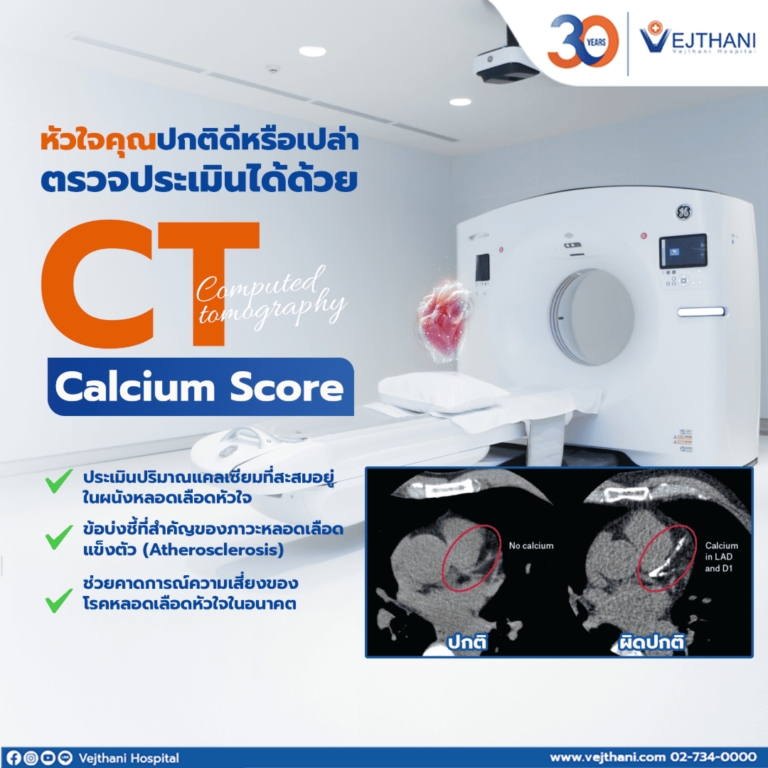CT Calcium Score การตรวจหาแคลเซียมหลอดเลือดหัวใจเพื่อประเมินความเสี่ยง ...