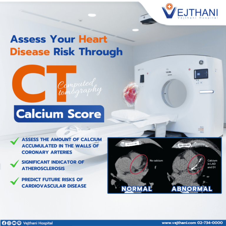 Assess Your Heart Disease Risk through the CT Calcium Score Diagnostic ...