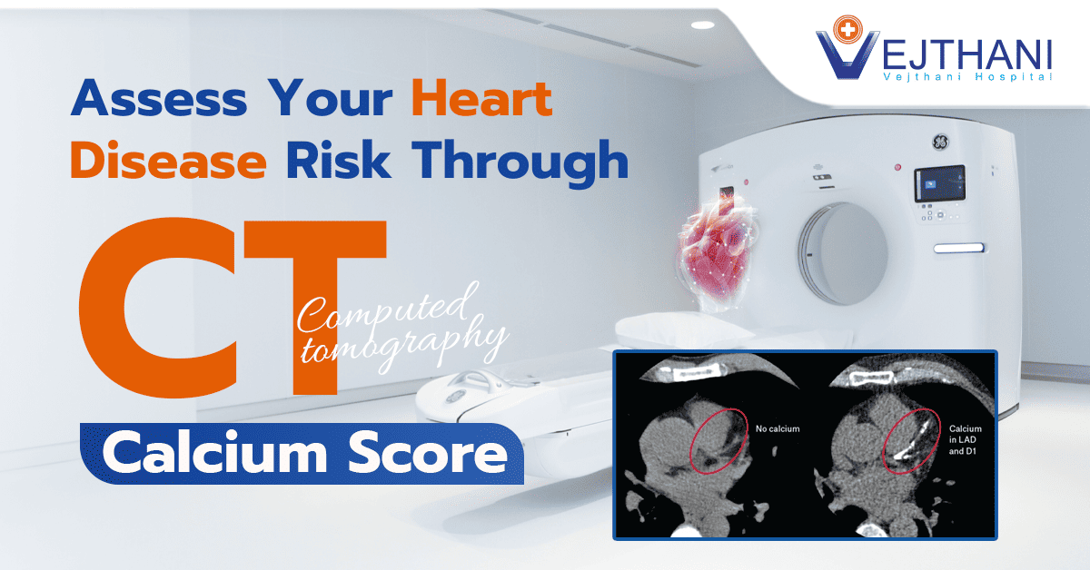 Assess Your Heart Disease Risk through the CT Calcium Score Diagnostic ...