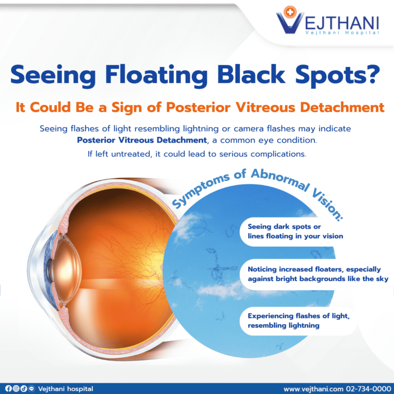 Seeing Floating Black Spots? It Could Be a Sign of Posterior Vitreous ...