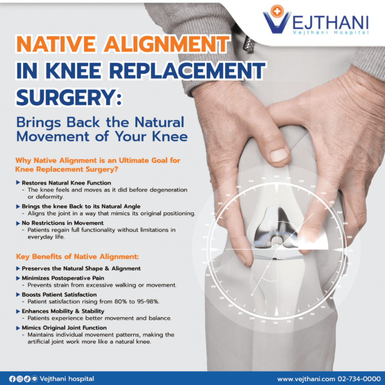 Native Alignment in Knee Replacement Surgery: Brings Back the Natural ...