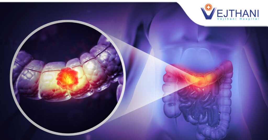 Don't Delay: Men Over 50 are at Risk for Colon Cancer