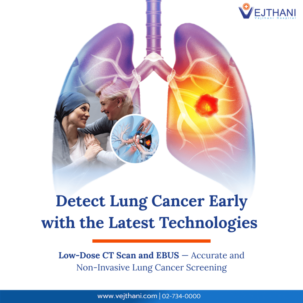Detect Lung Cancer Early with the Latest Technologies: Low-Dose CT Scan ...