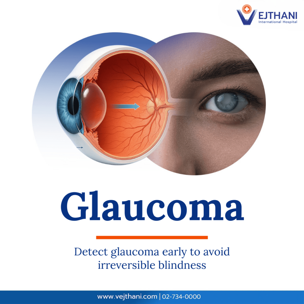 Detect Glaucoma Early to Avoid Irreversible Blindness - Vejthani ...