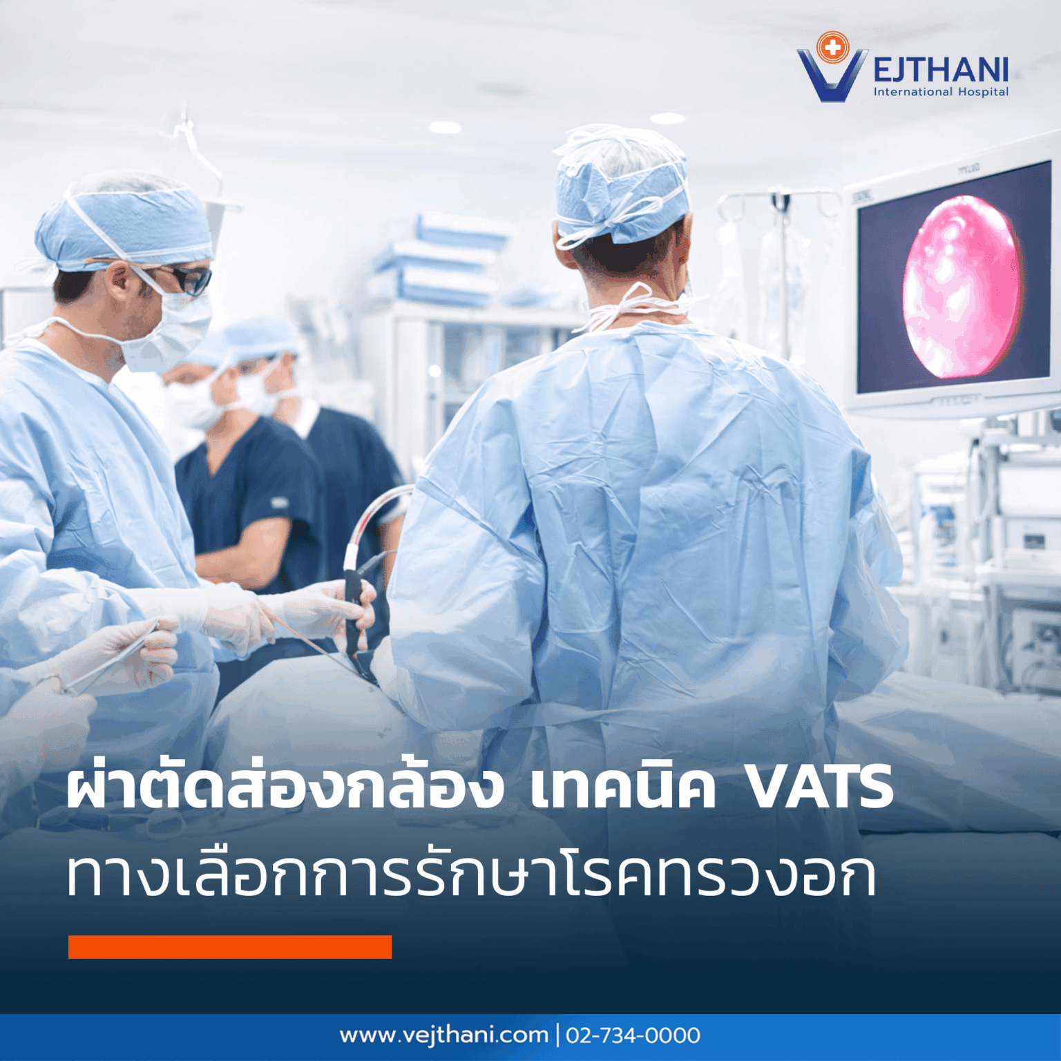 ผ่าตัดส่องกล้อง VATS ทางเลือกการรักษาโรคทรวงอก
